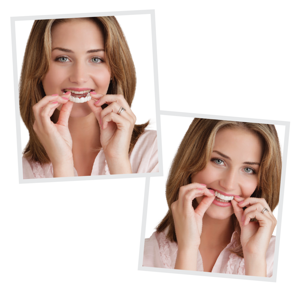 Snap-On Smile – Transform your smile. Change your life.